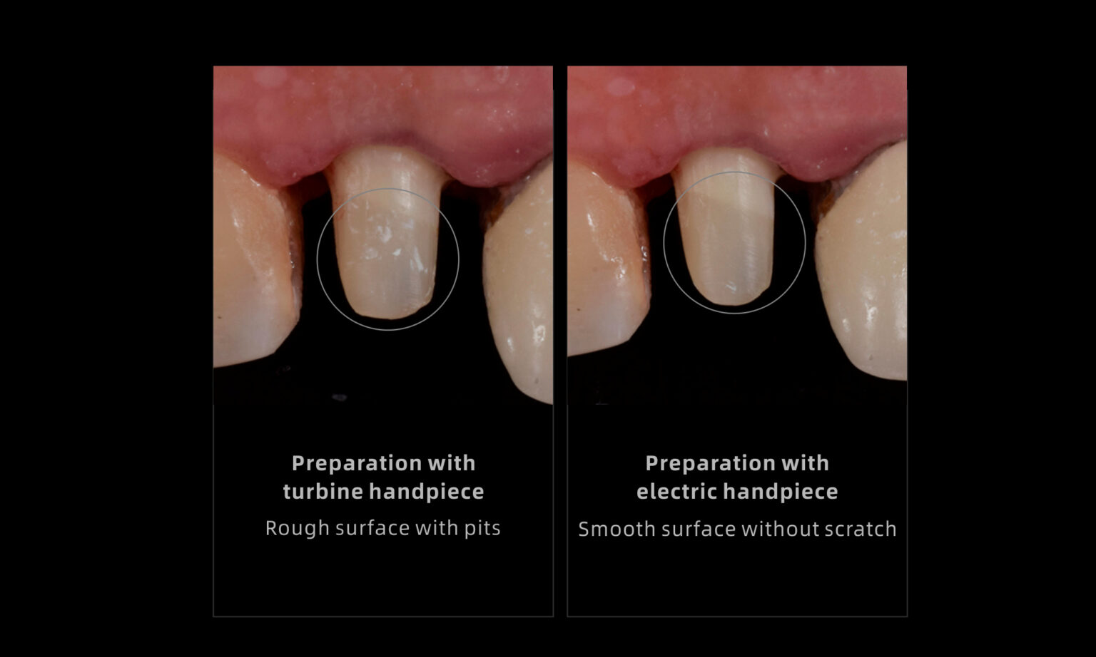 Punta SL5 – MEDIFIX